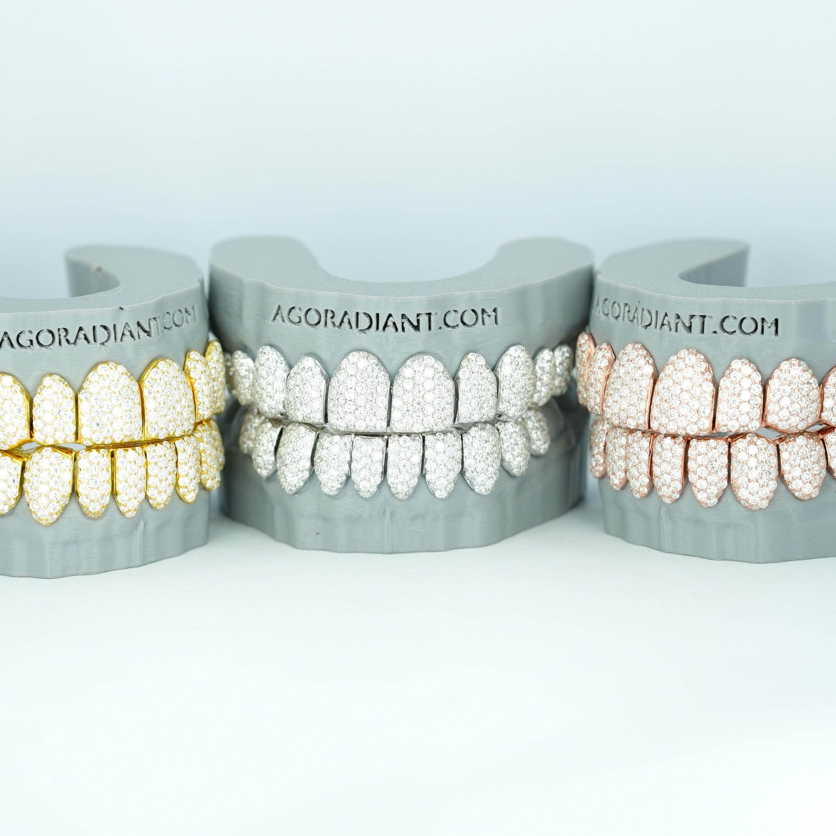 Moissanite Grillz – Agoradiant
