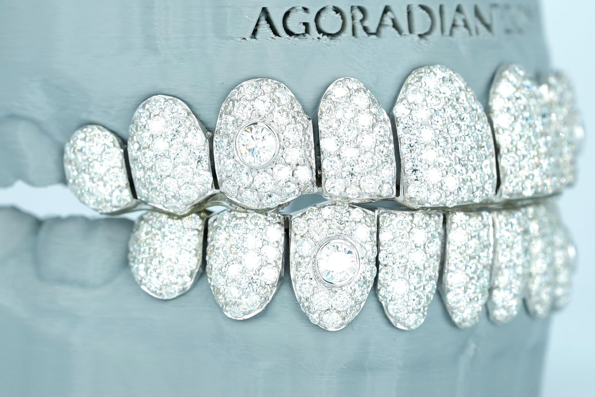 15 Pointer Stone On Fang VVS Moissanite Diamond Grillz – Agoradiant