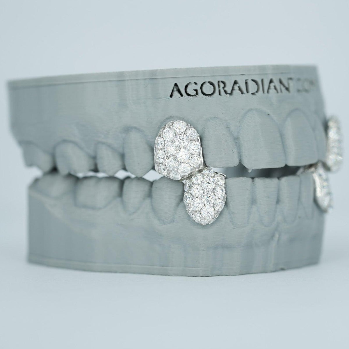 Fang With Back Bar 6 Pointer VVS Moissanite Diamond Grillz – Agoradiant